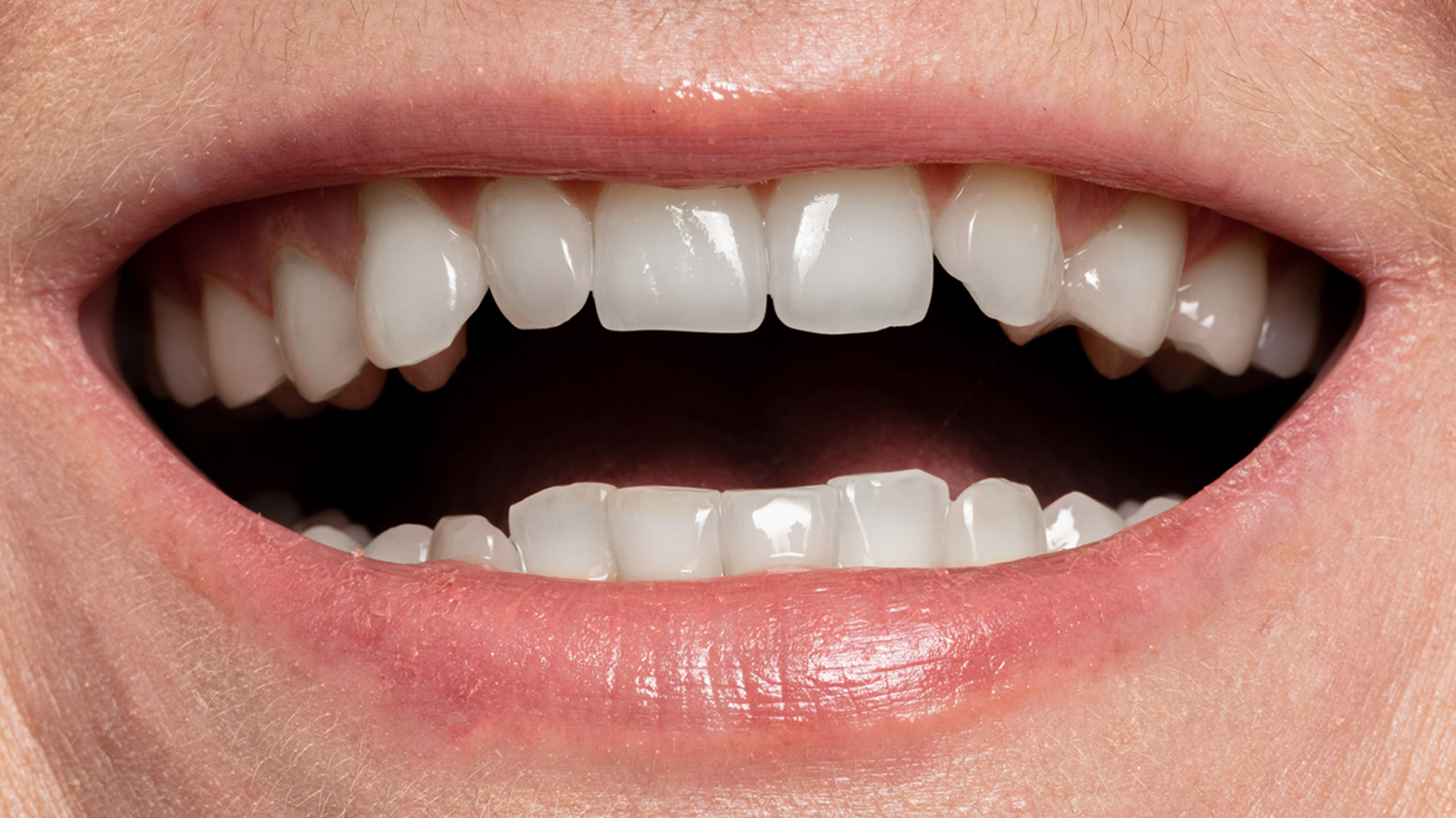 Home 03 Dentist – Merit